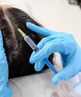 PRP Hair Treatment, Membantu Rambut jadi Subur